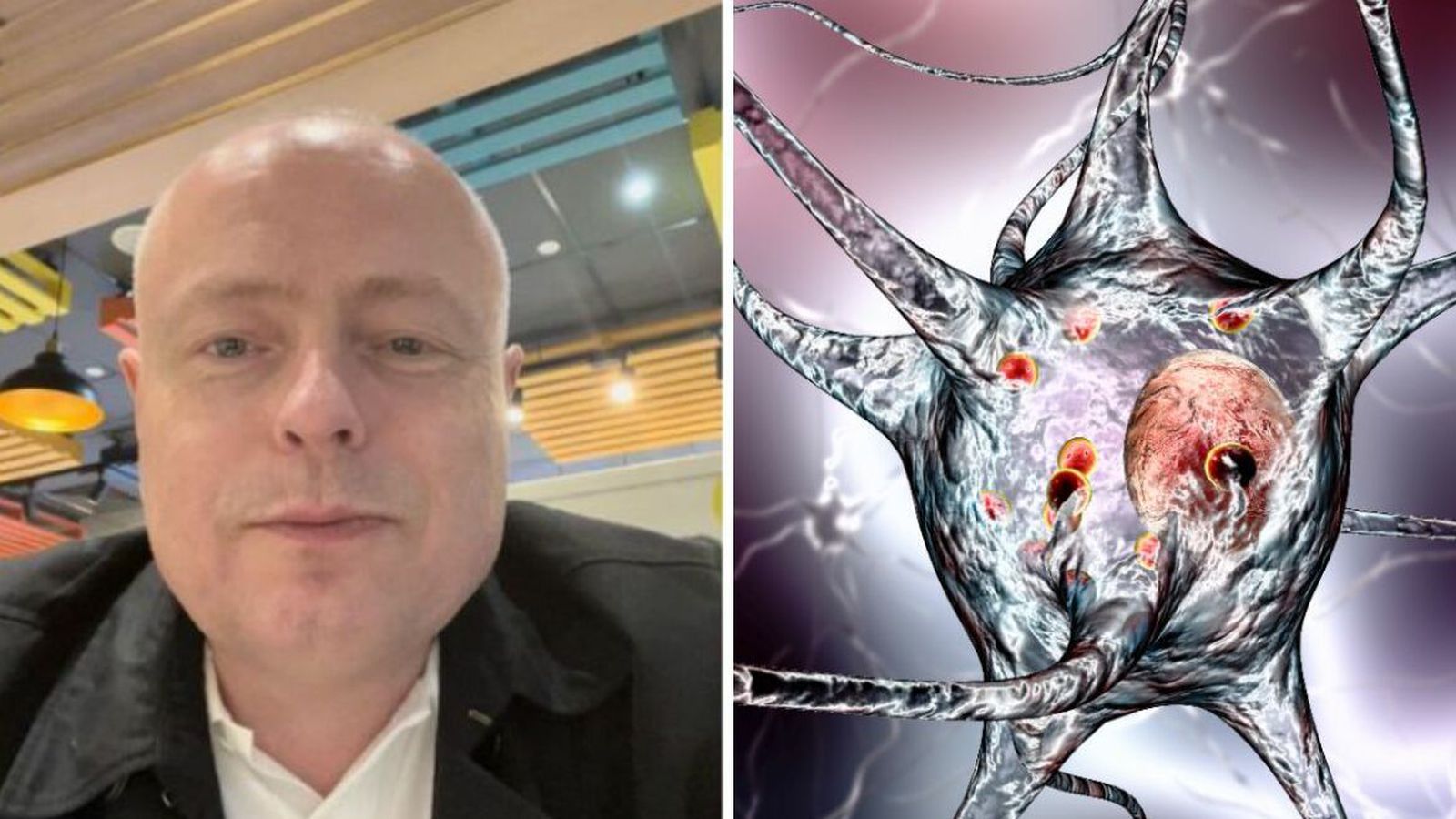 Stefna á að lækna Parkin­son með í­græðslu stofn­fruma - Vísir