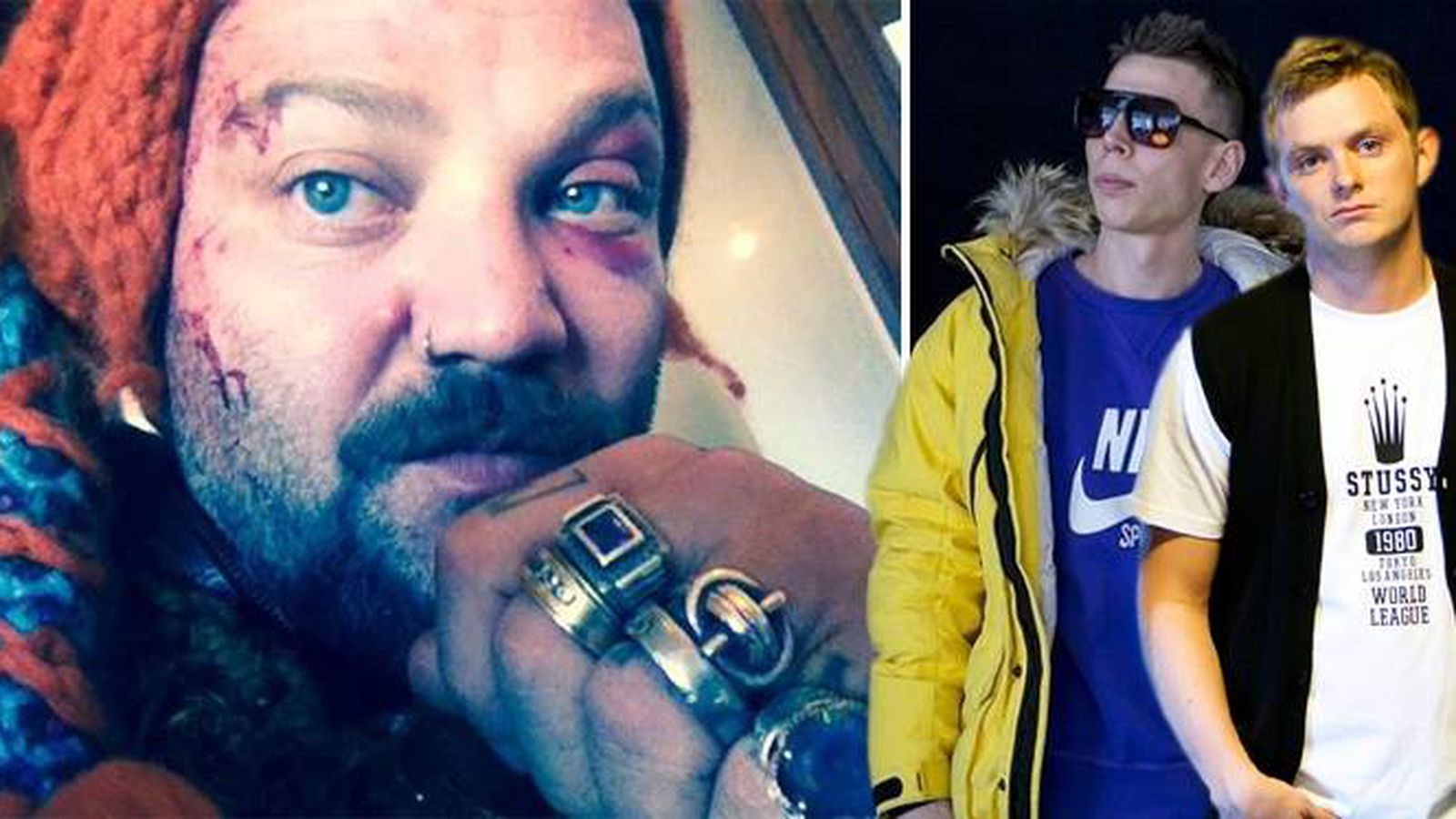Bam Margera files charges against popular rappers in Iceland - Vísir
