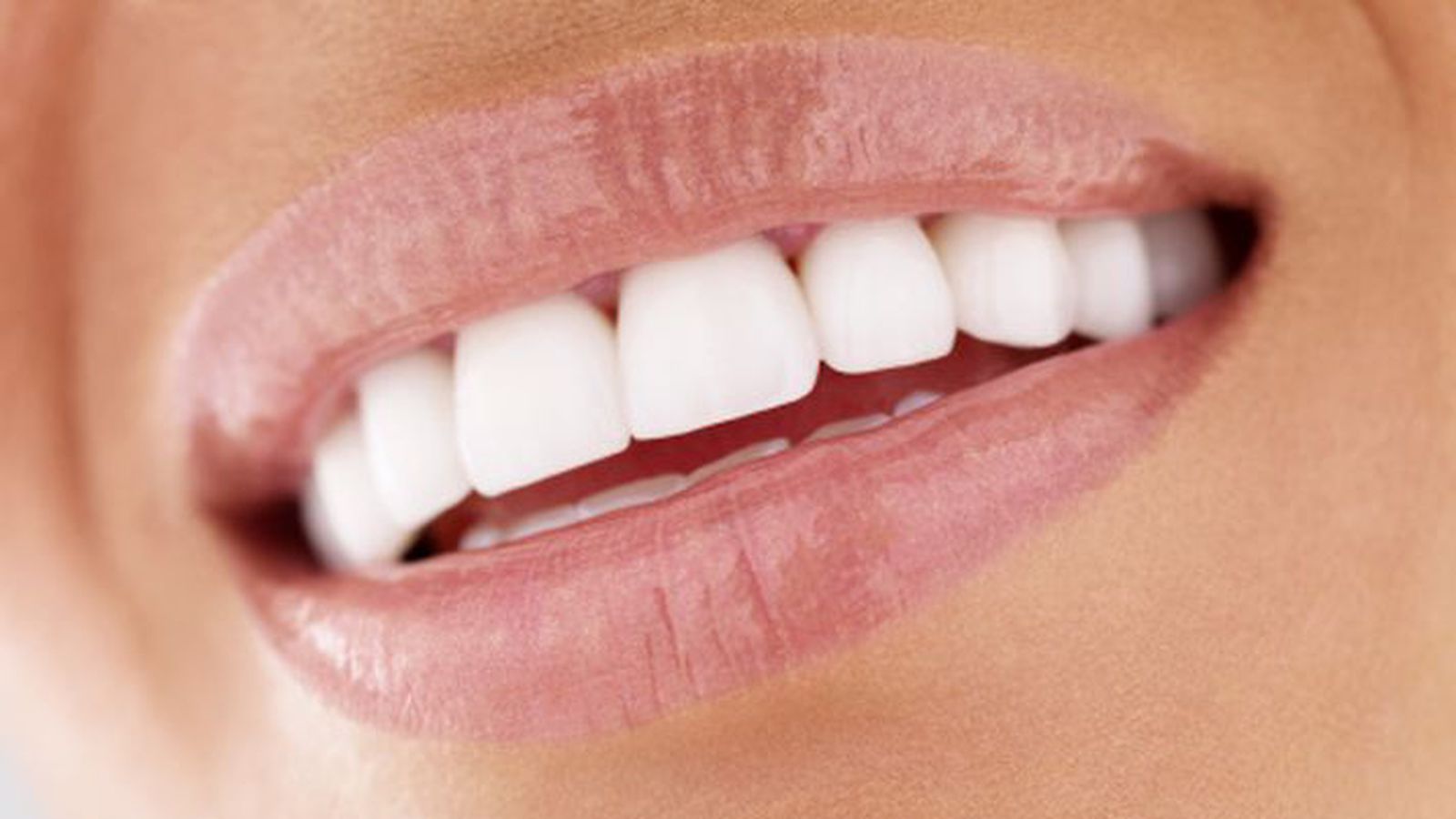 Bítið - Er slæmt að bursta tennur eftir morgunmat? - Útvarp - Vísir